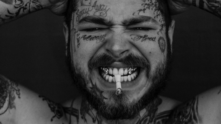 Quickies: Post Malone drops $1.6 Million on diamond fang veneers and ...