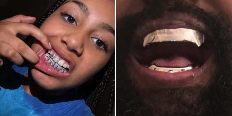 North West Shows Off Diamond Grills as Dad Kanye West Debuts Titanium ...