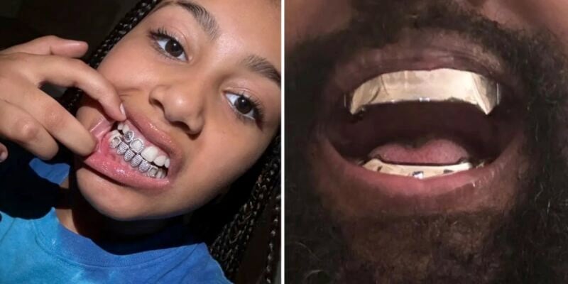 North West Shows Off Diamond Grills as Dad Kanye West Debuts Titanium ...